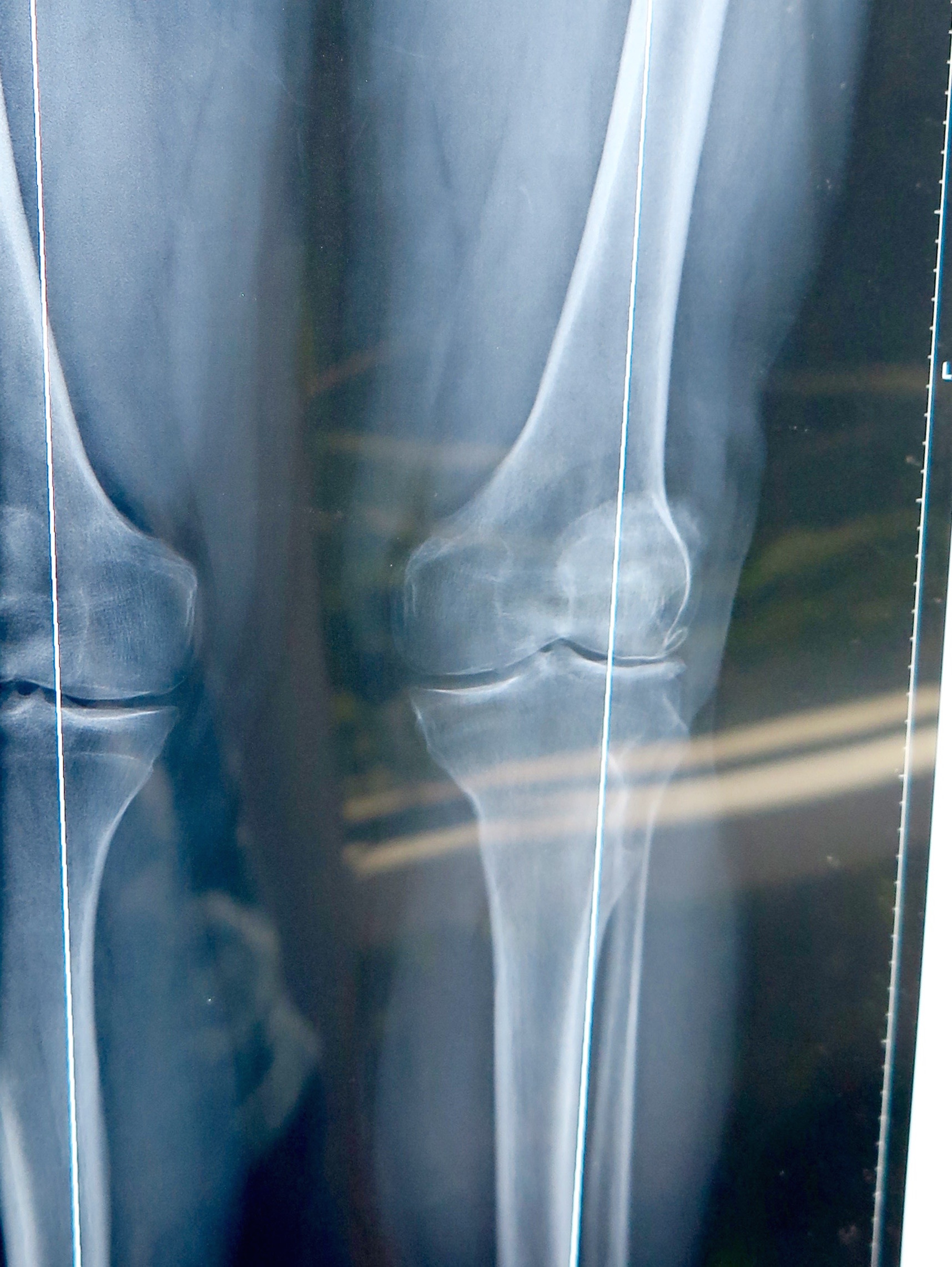 The Knee | mcraeblog